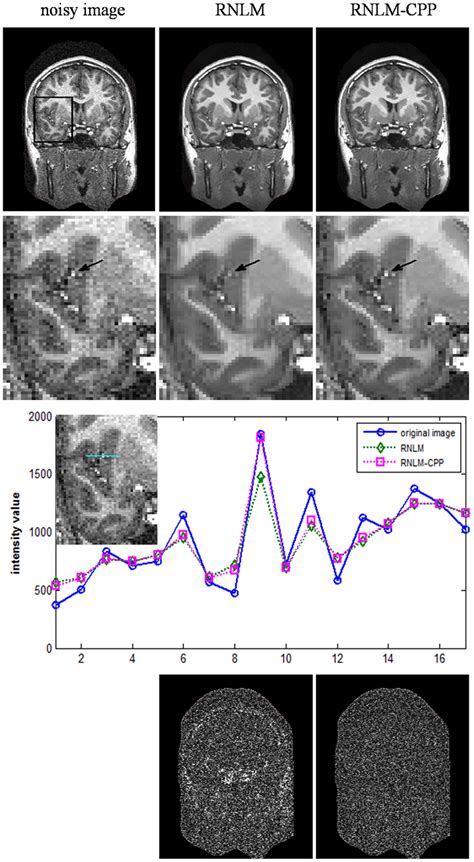 Comparison Of Rnlm And Rnlm Cpp Algorithms On Denoising Real T1