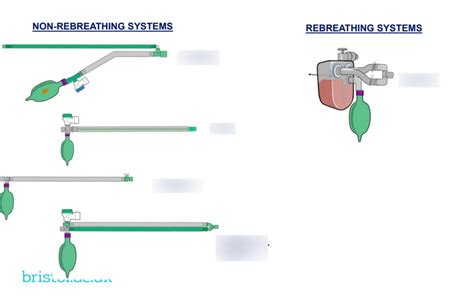 Anaesthesia Calculations Diagram Quizlet