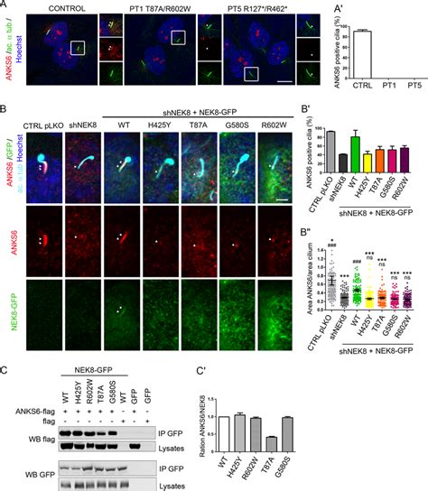 Nek Mutations Prevent Anks Localization At The Invs Compartment And Download Scientific