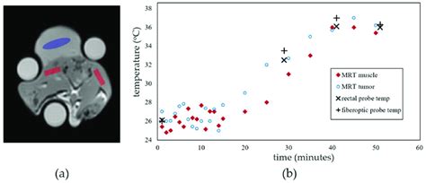 In Vivo Mr Thermometry Data And Temperature Probe Data A Axial Slice Download Scientific