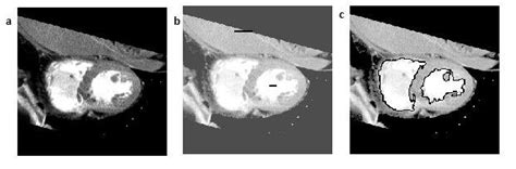 Overview Of Segmentation Computation Download Scientific Diagram