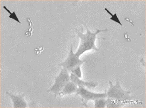 你的细胞是被什么污染了？全面介绍细胞污染有哪些种类 知乎