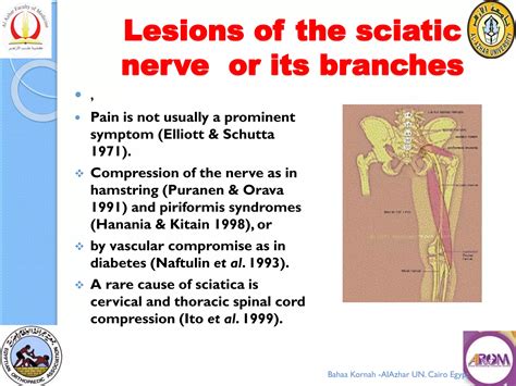 Extra Spinal Causes Of Sciatica And A Causes Algorithm Ppt