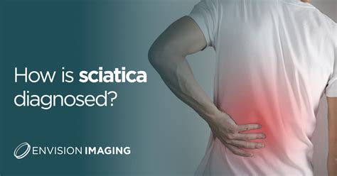 Sciatica