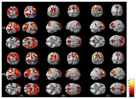 Functional Connectivity Maps Of The Central Executive Network Cen A Download Scientific