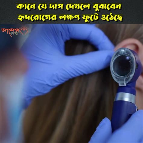 কানে যে দাগ দেখলে বুঝবেন হৃদরোগের লক্ষণ ফুটে ওঠেছে। কানে যে দাগ দেখলে বুঝবেন হৃদরোগের লক্ষণ
