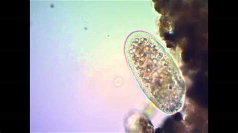 Инфузория туфелька под микроскопом under microscope - YouTube