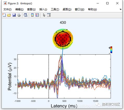 eeglab中文教程系列 6 数据叠加平均{1} data averaging eeg erp数据未叠加平均 csdn博客