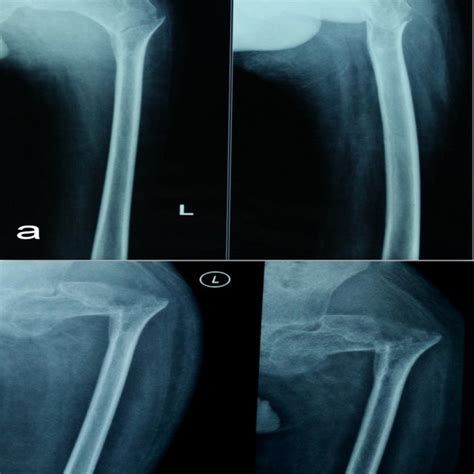 Graphic Representation Showing Age And Sex Distribution Of The Cases Download Scientific Diagram