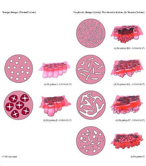 Schematic Representation Of The Crypt Pattern Modified From 89 Download Scientific Diagram