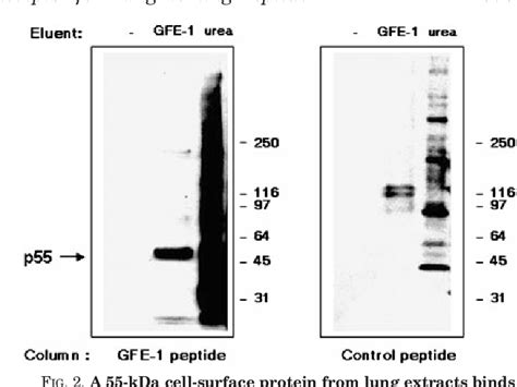 Figure 1 From Membrane Dipeptidase Is The Receptor For A Lung Targeting
