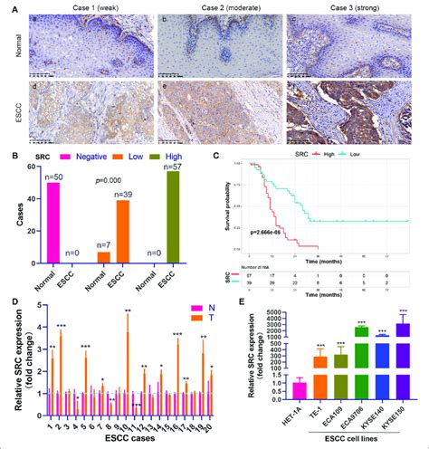 src expression is elevated and correlated with poor prognosis in