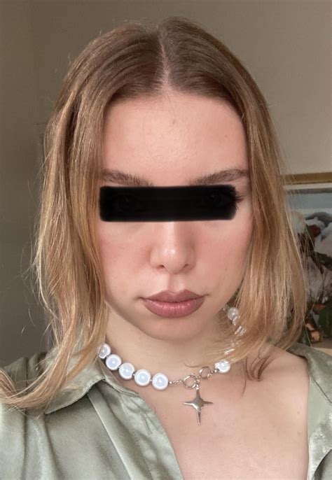 Does This Look Like Buccal Fat Or Enlarged Masseter Muscles Or Saggy