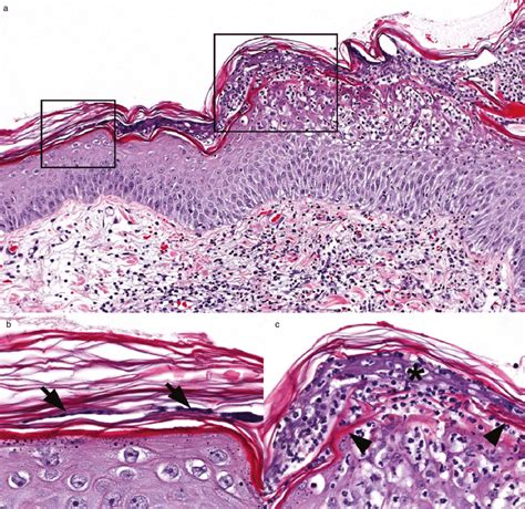 Is Pyoderma In Dogs Fatal