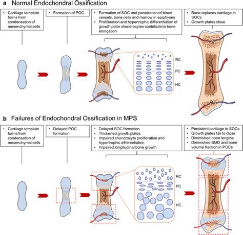 Endochondral Bone Formation Steps
