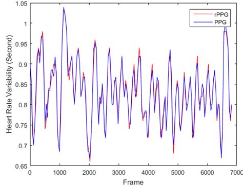 Comparison Between HRV And RHRV Temporal Signals Download Scientific Diagram