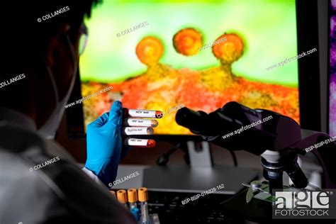 Blood Tests To Detect Sexually Transmitted Diseases Or STDs Hepatitis B And C Syphilis HIV