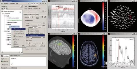 EEG信号处理与分析常用工具包介绍 知乎