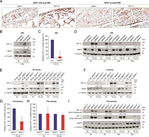 Bap1 Is A Novel Regulator Of Hif 1α Pnas