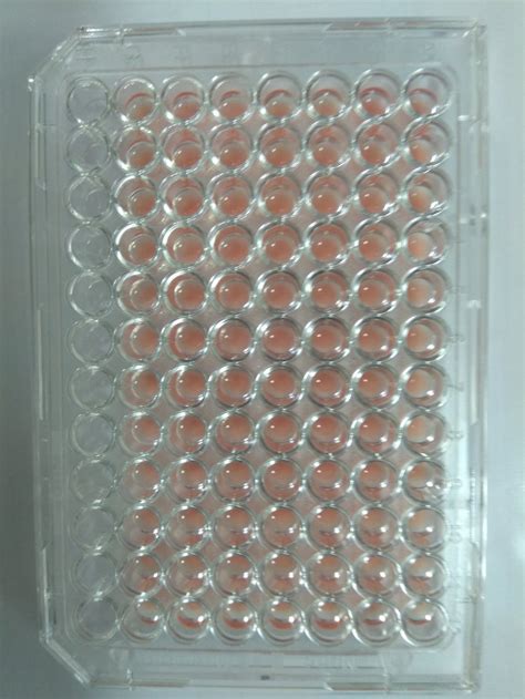 How To Prevent Rbc Lysis During Separation From Whole Blood Researchgate