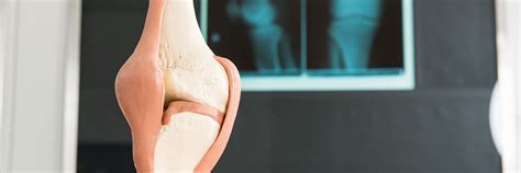 About Meniscus Arthroscopy Recovery Time And More