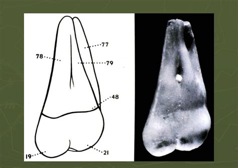 Maxillary 3rd Molar Buccal View Diagram Quizlet