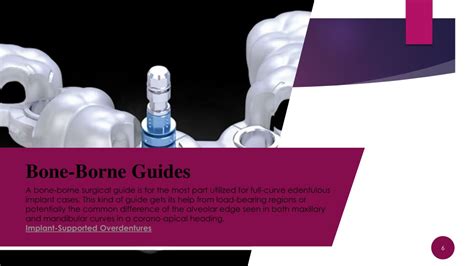 Ppt Surgical Guide Techniques For Dental Implant Placement Powerpoint