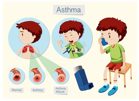 Asthma Alert Recognize And Respond To Asthma Attacks Like A Pro