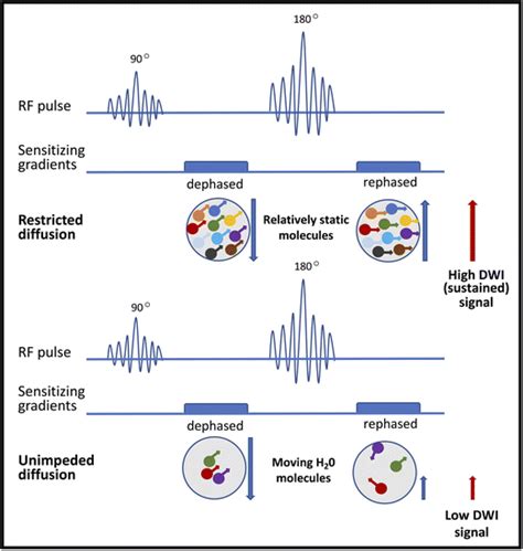 Schematic Illustration Of The Principle Of Diffusion Weighted Sequence Download Scientific