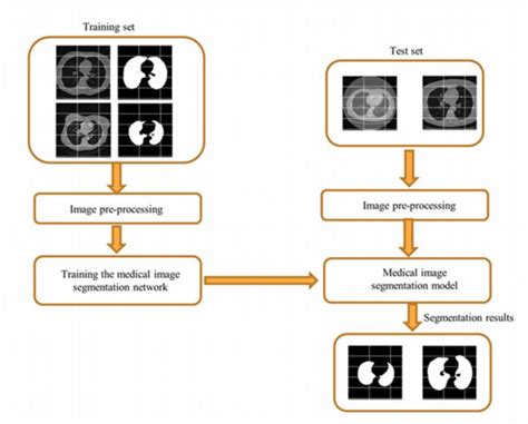 ct medical image segmentation algorithm based on deep learning technology