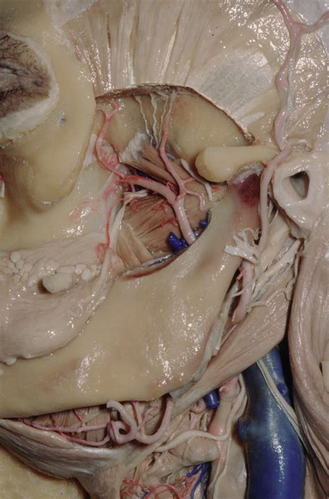 Lateral Perspective Of The Infratemporal Fossa Neuroanatomy The Neurosurgical Atlas