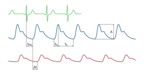 pulse wave parameters vascular academy powered by sot