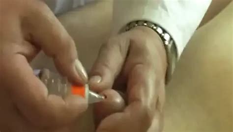 Catheter Insertion Xhamster