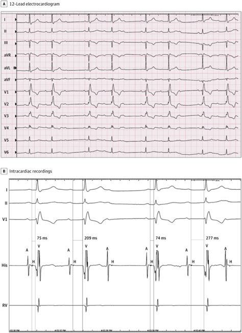 Jama Internal Medicine On Linkedin Case Report The Findings Of Echocardiogram And Intracardiac