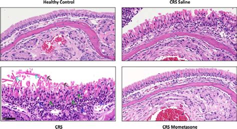 Respiratory Epithelium Of Healthy Mice Crs Mice Saline And Mometasone Download Scientific