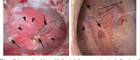 Figure 1 From A Proposed Grading System To Standardize The Description