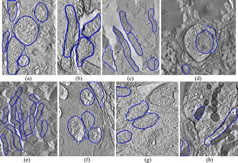 Figure 13 From A Validated Active Contour Method Driven By Parabolic Arc Model For Detection And