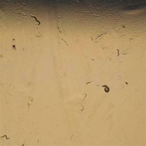 Worm Data Object Detection Dataset By Shoubhik