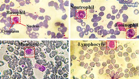 Lymphocytes Under Microscope