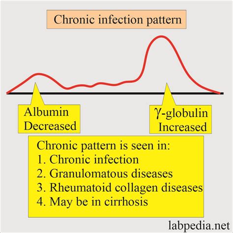 Immunoglobulin Electrophoresis Immunoglobulins Pattern In Various