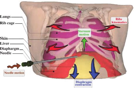 patient customized anatomy with inhalation motion and needle avatar