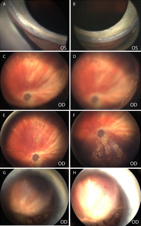 Pectinate Line Radiology At Mary Lockridge Blog
