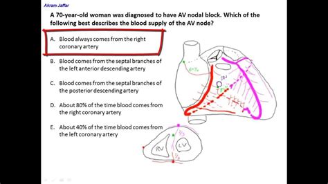 What Are The Sources Of Blood Supply Of The Av Node Youtube