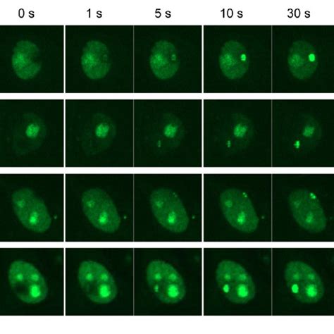 wrn disease mutations in classical ws patients rectangular box shows