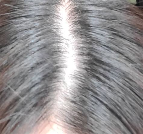 여잔데 이거 혹시 탈모야 가르마 사진첨부 인스티즈 Instiz 일상 카테고리