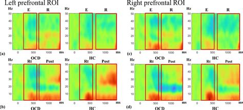 Event Related Spectral Perturbation Ersp Map During The Delayed