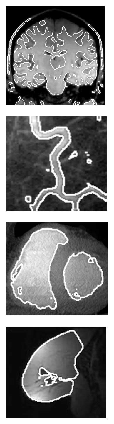 Segmentation Results Of Various Medical Images By Proposed Method The Download Scientific