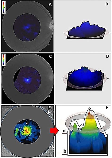 Comparative Evaluation Of The Mpod Measured With The Visucam 500 ® Download Scientific