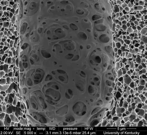 Scanning Electron Microscopy Sem Gallery Electron Microscopy Center