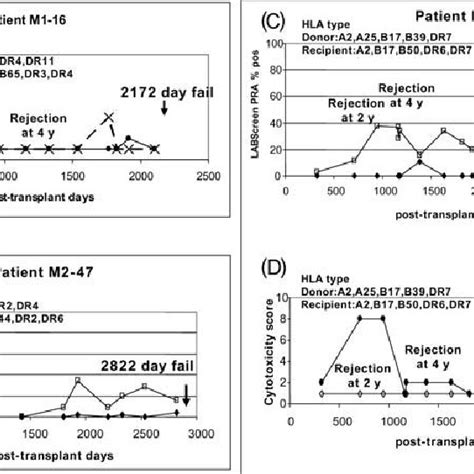 Examples Of Patients With Hla And Mica Antibodies That Did Not Increase Download Scientific